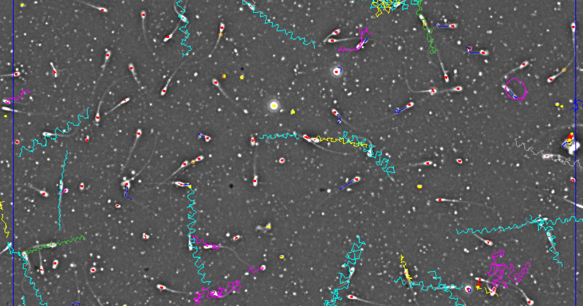 UNDERSTANDING COMPUTER ASSISTED SPERM ANALYSIS (CASA) OPTIONS: SORT II ...