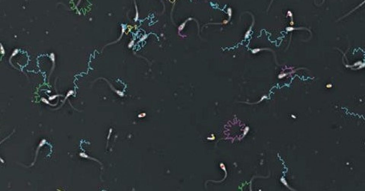 Understanding computer assisted sperm analysis (CASA) kinematics ...